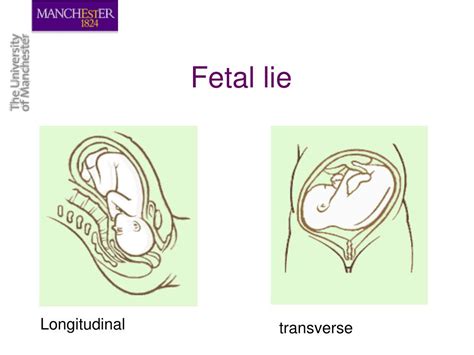 Ppt Antenatal Care Powerpoint Presentation Free Download Id1196014