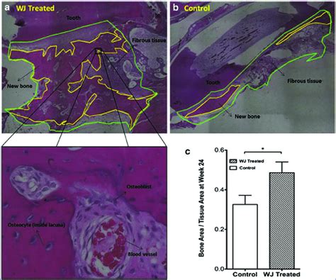 Histomorphometric Analysis Of Bone Regeneration In Alveolar Defects Download Scientific Diagram