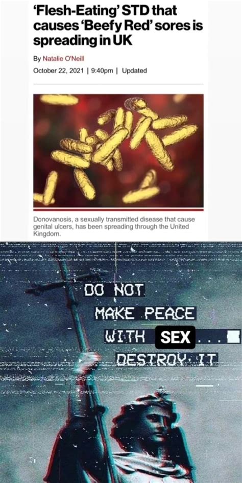 Flesh Eating STD That Causes Beefy Red Sores Is Spreading In UK By Natalie O Neill October