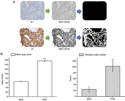 Figure 2 From Her2 Classification In Breast Cancer Cells A New
