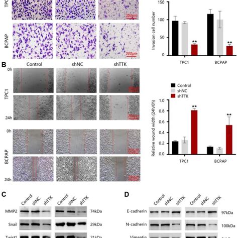 Ttk Promotes Ptc Cell Invasion And Migration A The Invasion Of Tpc1 Download Scientific