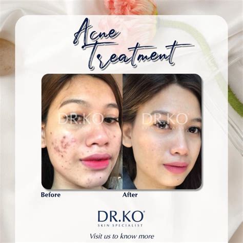 4 Klinik Dermatologi Terbaik Di Ipoh 2026