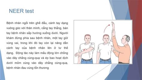 Hội Chứng Chèn ép Dưới Mỏm Cùng Vai Youtube