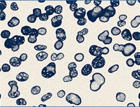 Longcell Single Cell And Spatial Alternative Splicing Analysis With Nanopore Long Read