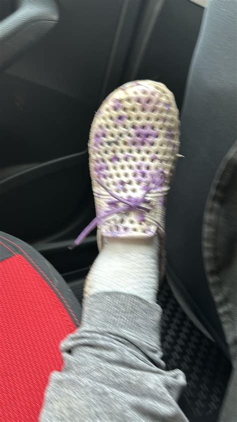 My First Broken “bone” R Brokenbones