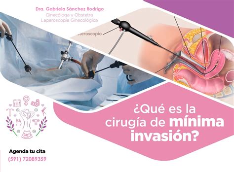 Dra. - ¿Qué es la cirugía de mínima invasión? La cirugía mínimamente invasiva consiste en operar ...