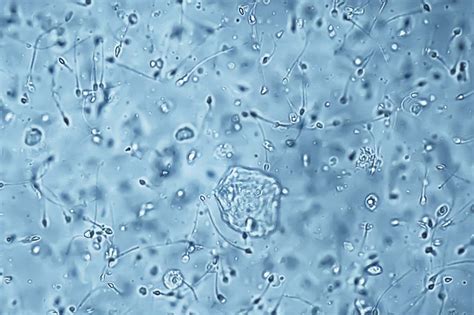 Male Birth Control Injection Causes Reversible Infertility In Mice