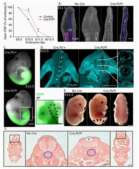 Regional Deletion Of Fgfr1 Causes Delayed Pnp Closure And Localized