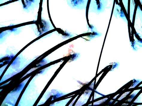 Opencv Hair Counting Algorithm Stack Overflow