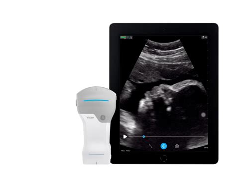 Ge Vscan Air Aie Llc