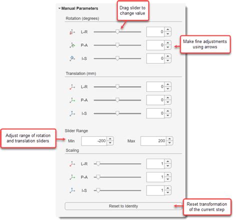Get Started With Medical Registration Estimator Matlab And Simulink