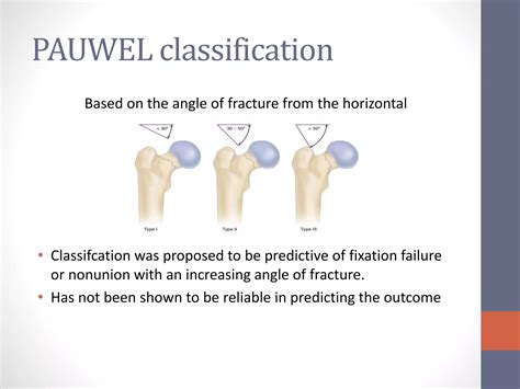 Neck Of Femur Fracture Pptx