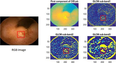 Figure 10 From Multi Scale Analysis Of Ulcer Disease Detection From Wce