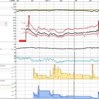 The Colour Density Spectral Array In The Intensive Care Unit No Download Scientific Diagram