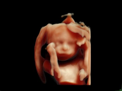 Safe Prenatal Ultrasounds In Jackson Ms Trusted And Accurate Care
