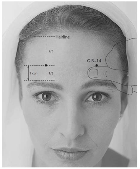 Vb G B 14 ян бай янская белизна Yangbai 陽白 Особенности точка наследственно