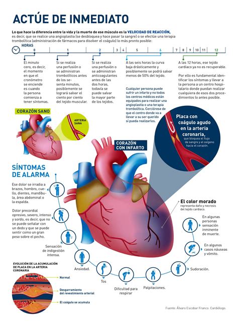 ¿cómo Diferenciar Un Infarto De Otras Patologías Chhdm