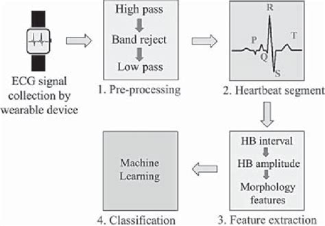 2 Steps Of Ecg Heartbeat Classification Download Scientific Diagram