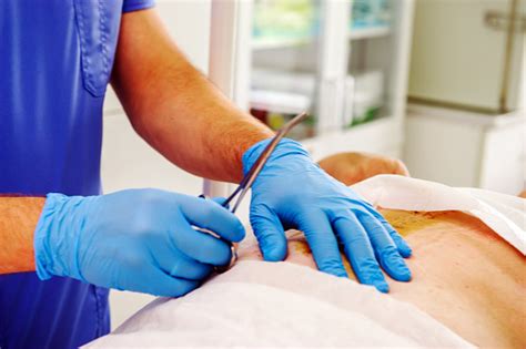 외과 의사와 조수가 수술을 수행하는 동안 의사의 손을 닫습니다 수술실에서 다양한 수술 도구를 사용하는 의료진 2명에 대한 스톡 사진 및 기타 이미지 Istock