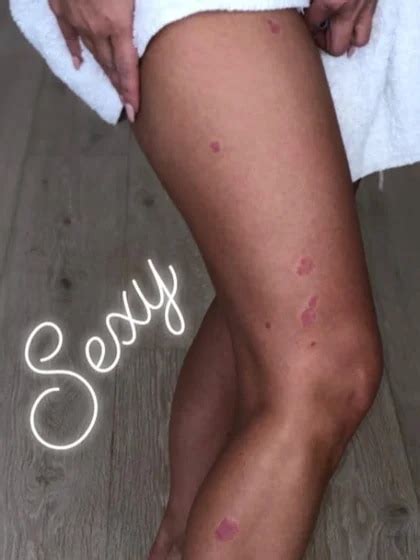 Kim Kardashian Posó Sin Maquillaje Para Mostrar Los Efectos De La