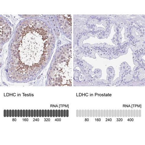 Ldhc Antibody Pa5 60999