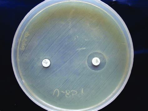 Phenotypic Confirmatory Disc Diffusion Test Showing An Increase In Zone Download Scientific