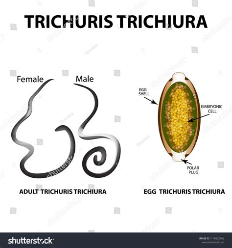 Acanthocephala Over 3 Royalty Free Licensable Stock Vectors And Vector