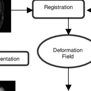 Atlas Based Segmentation Of ITK Download Scientific Diagram