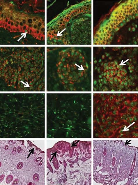 Sox10 Cd271 P75 Ntr Double Staining And Anti β Galactosidase