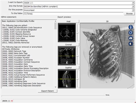 Best Free Tool For Dicom Data Anonymization Researchgate