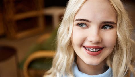 Metal Braces Dental Braces In Perth Ellenbrook Orthodontics
