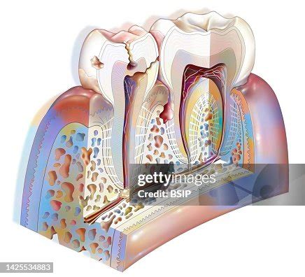 Tooth Pathology Drawing High Res Vector Graphic Getty Images