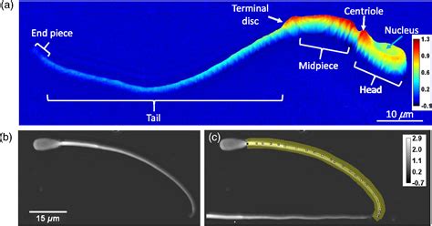 Topography And Refractometry Of Sperm Cells Using Spatial Light Interference Microscopy