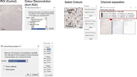 Representative Screenshots And Workflow For A Step By Step Color Download Scientific Diagram