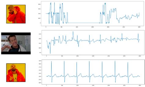 Towards Ai Based Only Biosignal Analysis Pipeline By Artem Bachynskyi