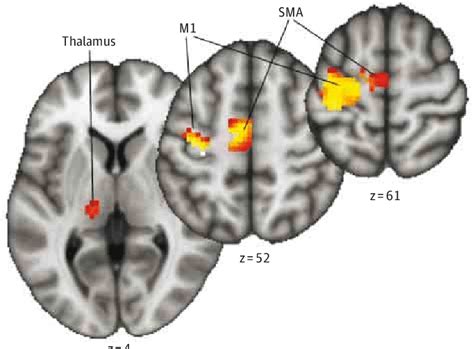 Group General Linear Model Differences Between Motor Imagery And Execution Download Scientific