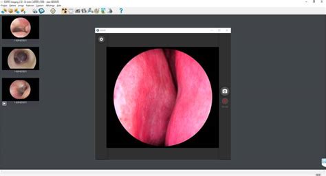 Medical Imaging Software Consulting Room Software Software Acteon