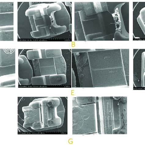 Different Bracket Types Viewed On Sem And Their Chemical Composition Download Scientific
