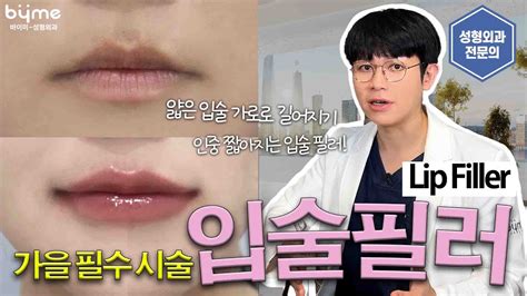 En 인중 축소 수술 No 입술필러로 얼굴 작아지는 법 공개합니다🚀 중안부 긴 얼굴 필수 시청 바이미 성형외과 최한뫼 원장 Youtube