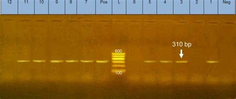 Photo 2 Detection Of Meca In Staphylococcal Isolates Obtained From