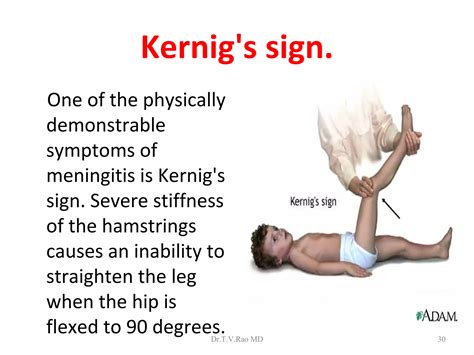 Bacterial Meningitis Ppt