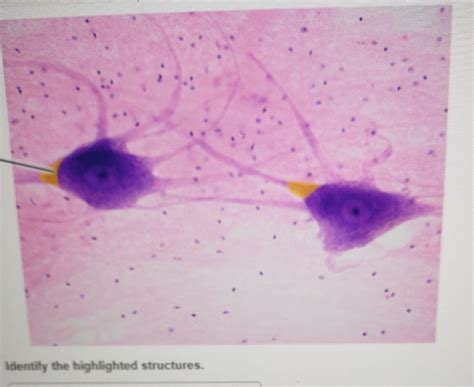 Solved Ldentify The Highlighted Structures