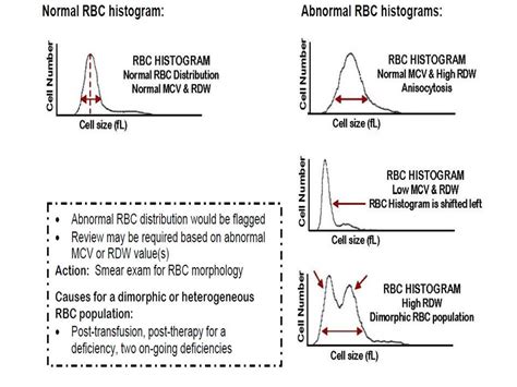 Platelet Histogram