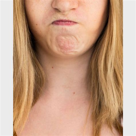 Dimpled Chin Treatment In Scottsdale Kora Aesthetics