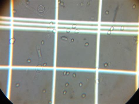 Could Somebody Suggest The Method Of Determining Trichoderma Or Other Fungi Spore Density