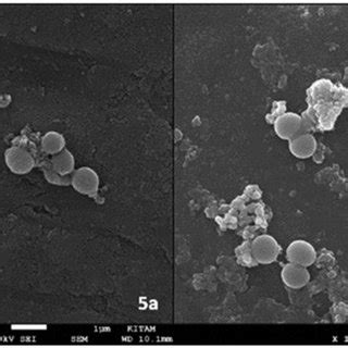A B SEM Images Of CPP ACP Group For H A And H B Download Scientific Diagram