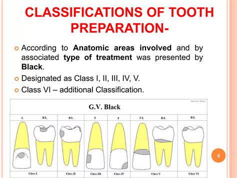Class I Cavity Preparation Pptx