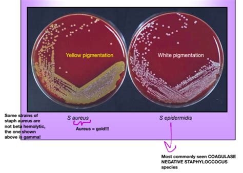 Staphylococcus Aureus Strep A