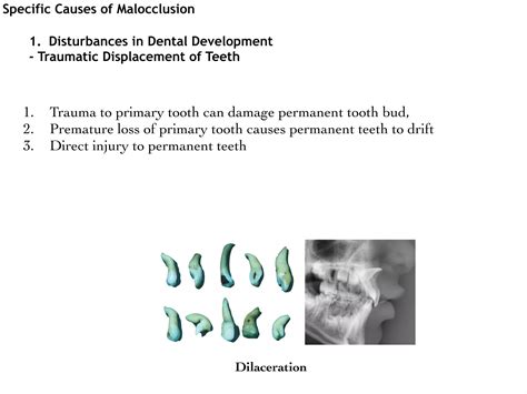Known Causes Of Malocclusion Pdf