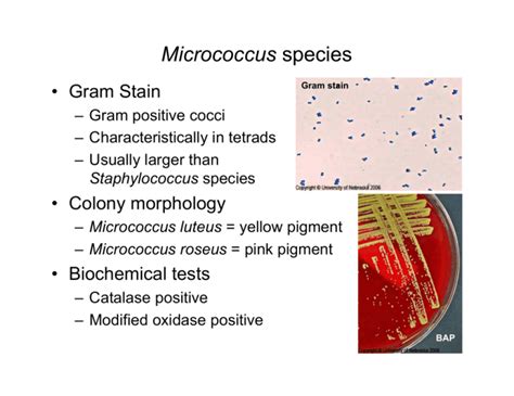 Micrococcus And Staphylococcus Identification